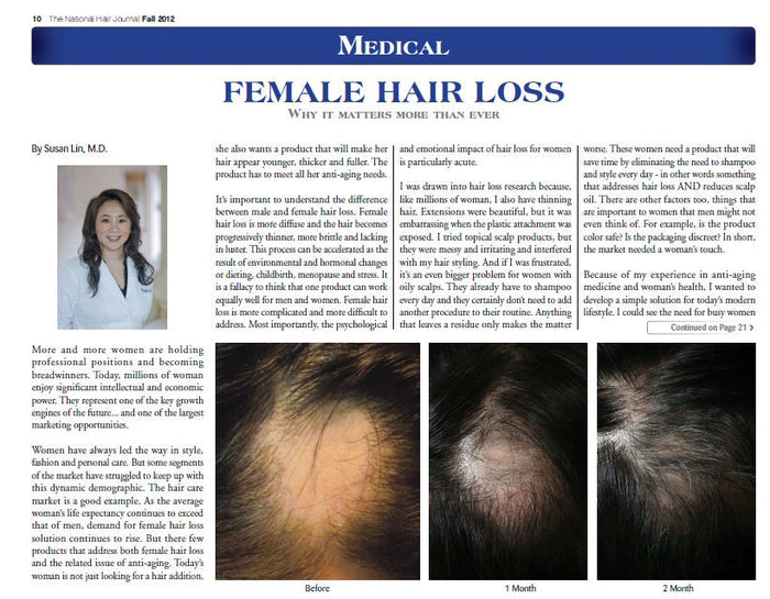 Postpartum Hair Shedding — Physician's Guide | MD – MD®