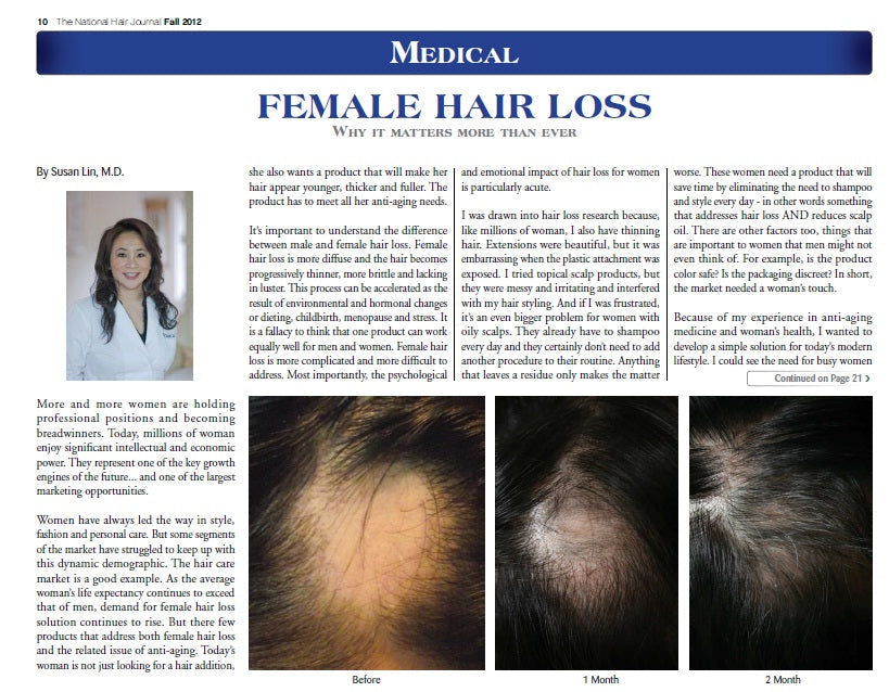 Postpartum Hair Shedding — Physician's Guide | MD – MD®